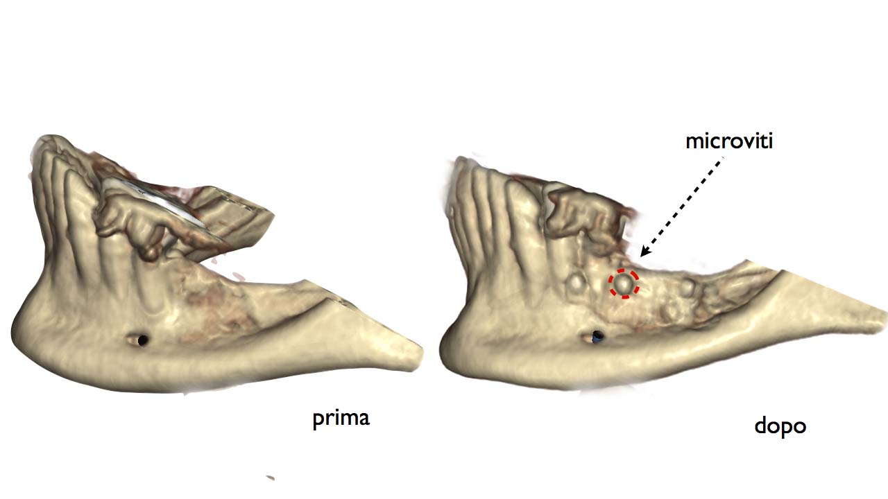 Lamina Corticale per rigenerazione ossea - Clinica Villa